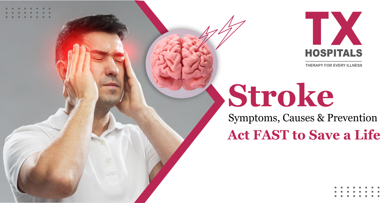 Stroke Symptoms, Causes, and Prevention: Act FAST to Save a Life