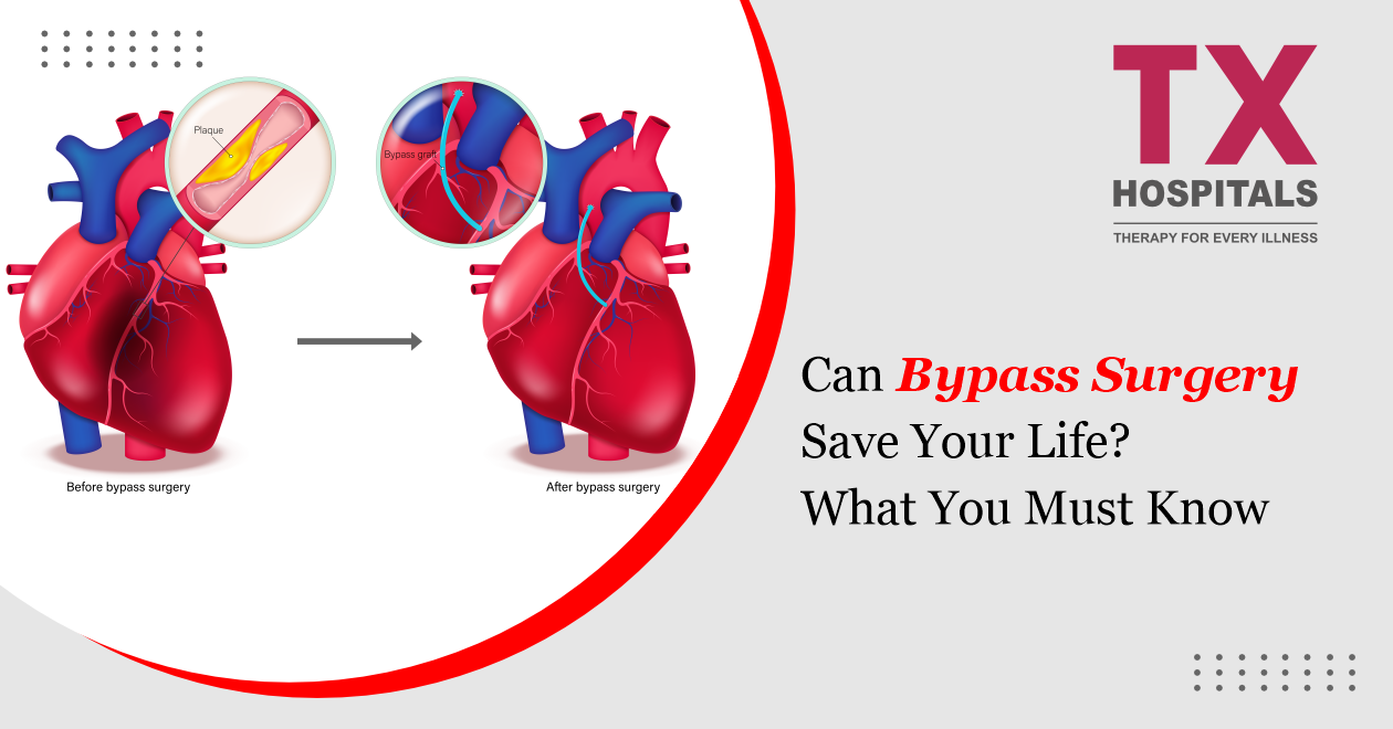 Can Bypass Surgery Save Your Life? What You Must Know