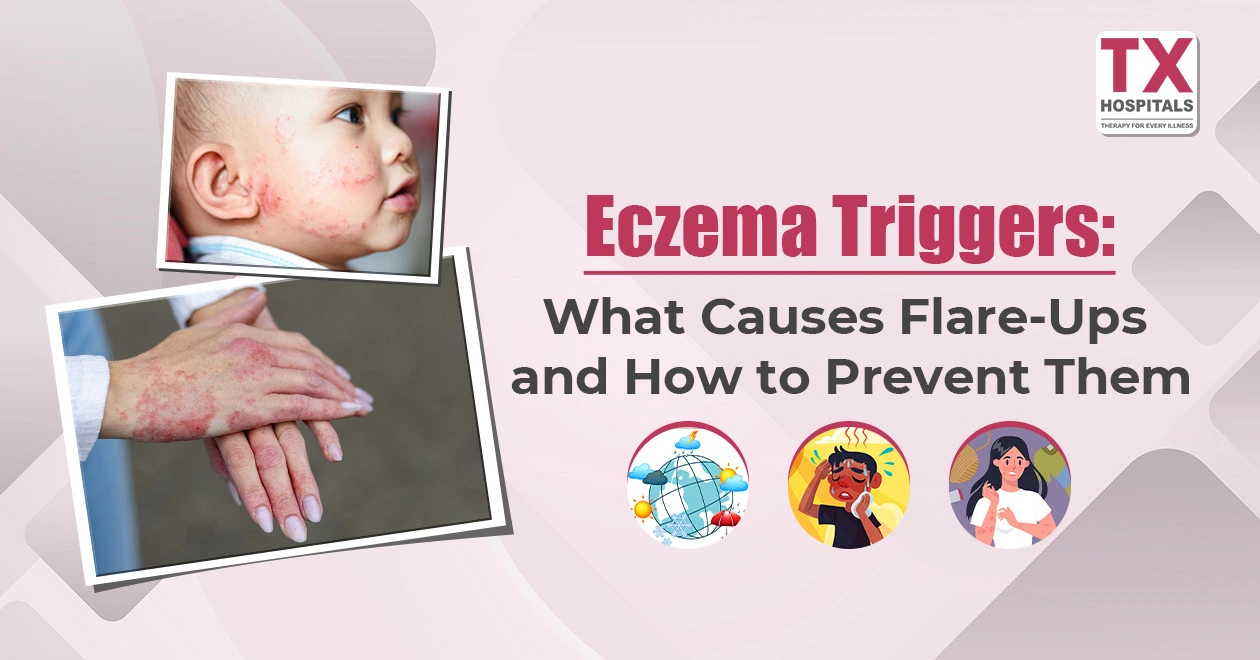 Eczema Triggers: What Causes Flare-Ups and How to Prevent Them