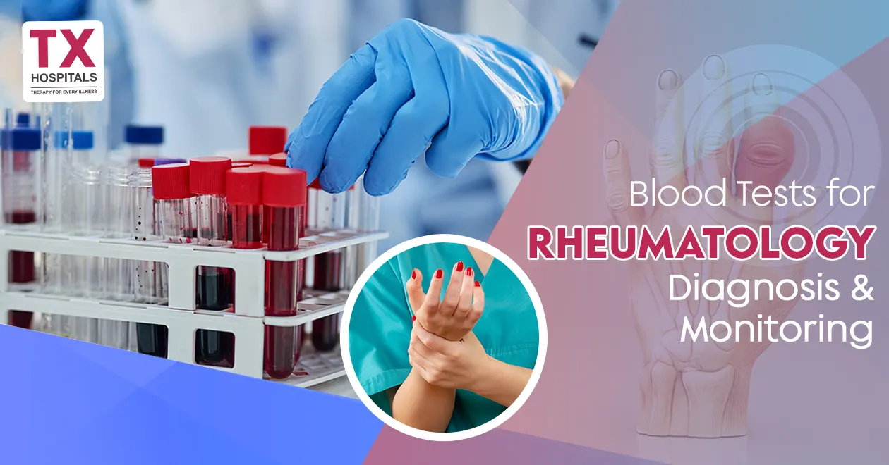 Blood Tests for Rheumatology Diagnosis & Monitoring