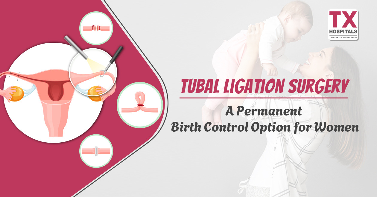 Tubal Ligation Surgery – Permanent Birth Control for Women